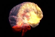 Sage Research Methods Video: Medicine and Health - Catalyst: Brain Stimulation/Diagnosing Depression