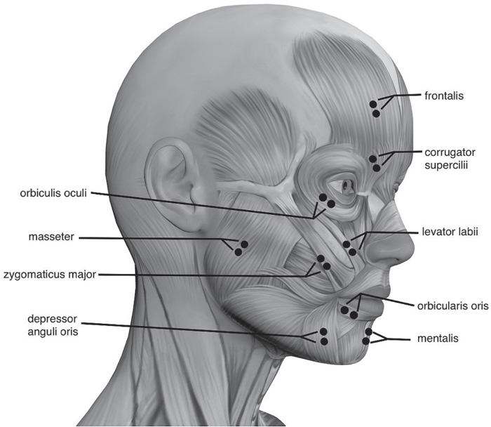 Electromyography Face